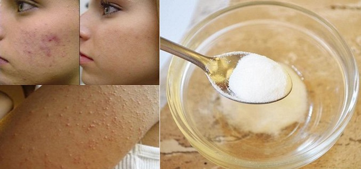 Apply This Mixture on Your Face and Your Skin Will Be Smoother than ...